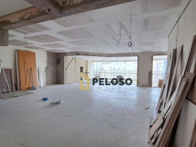 Apartamento à venda | 264m² | Andar alto | 4 suítes | 4 vagas | Alto de Santana São Paulo/SP